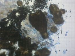 Périthèce de Sordaria (microscope) en culture - Phototheque du Ctifl