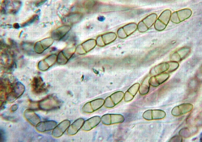 Asques et ascospores de Venturia inaequalis - Phototheque du Ctifl