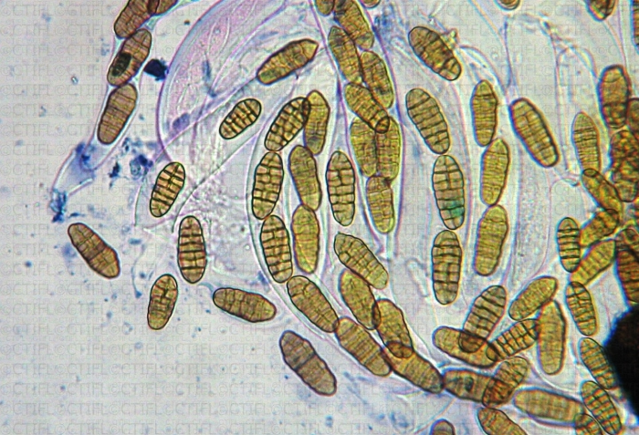 Asques et ascospores de Ploeospora - Phototheque du Ctifl